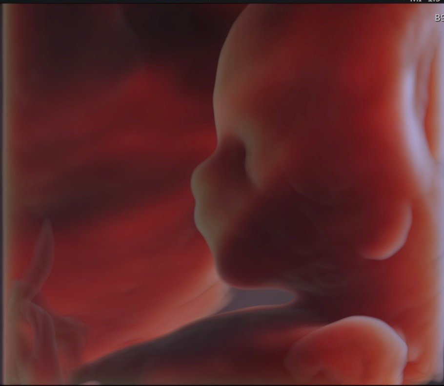 Real Glimpse™ Ultrasound